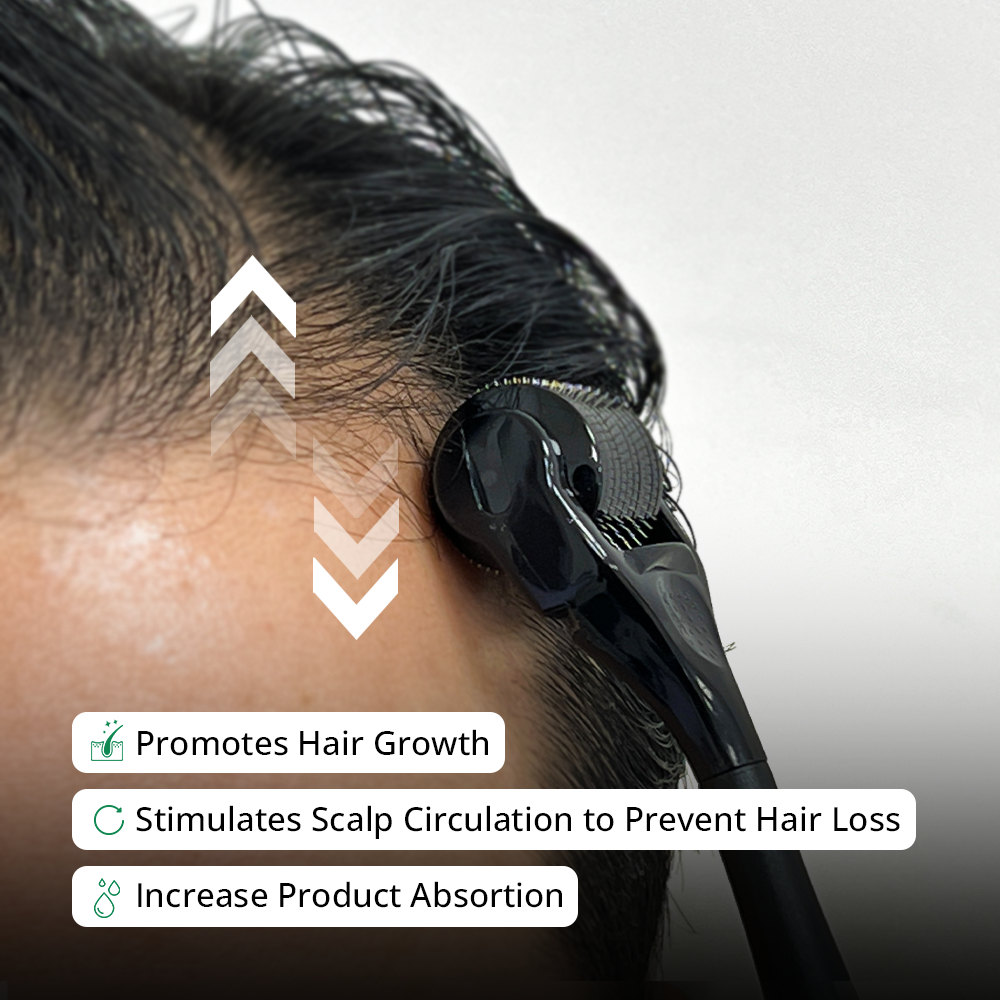 3 in 1 Scalp Pro Derma Roller 540 Titanium microneedles | For Hair Gro